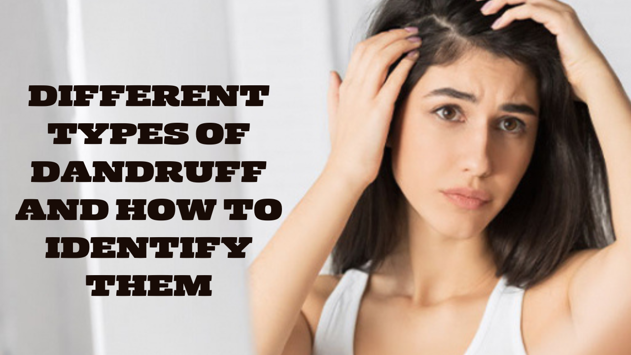 Different Types of Dandruff and How to Identify Them